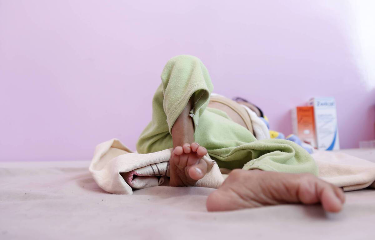 World record for acute food insecurity in 2021