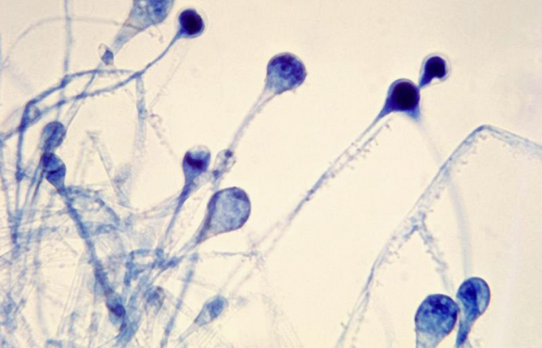 Heat drives fungal mutations that affect health