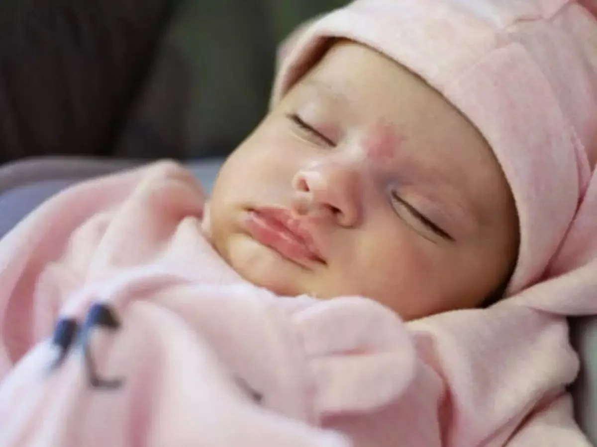 What the moles on your body reveal about your past lives