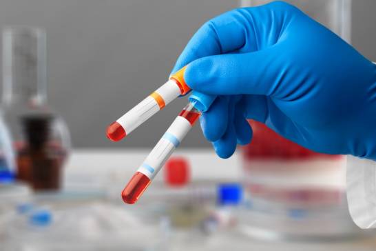 A blood test to calculate the aging of each organ and prevent disease