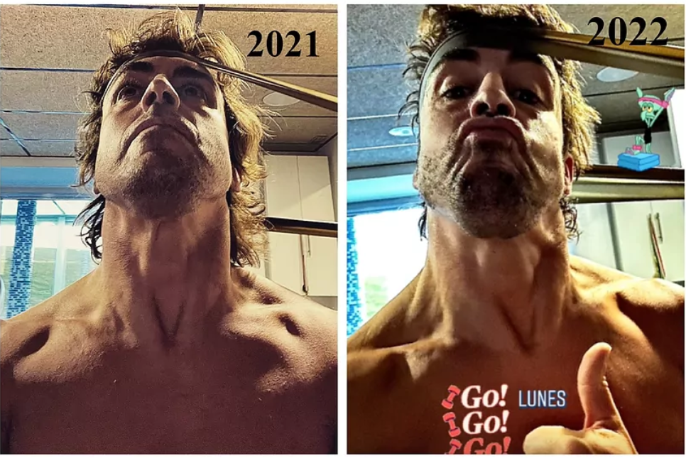 Alonso's Shocking Comeback: What's Behind the Bull's Neck Return