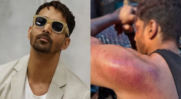 Harshvardhan Rane Injured Filming 'Sila'; Respects Akshay Kumar, Tom Cruise