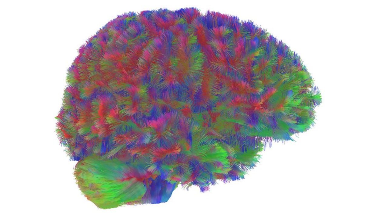 New Study Identifies Five Human Brain Stages, Key Shifts at 9, 32, 66, 83